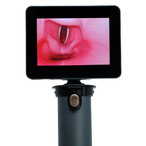 Mdpro Video Laryngoscope
