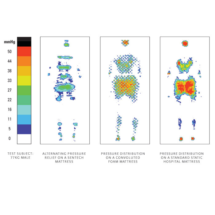 Buy SenTech Air Mattress Stage IV 2000 Online