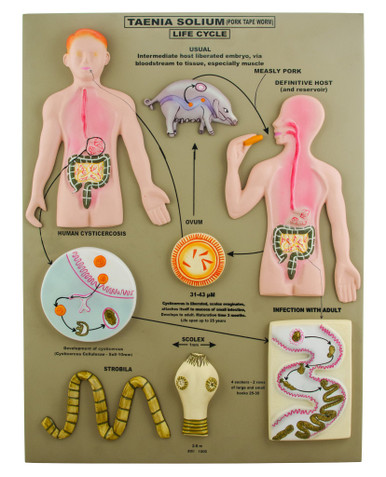 Pork Tapeworm (Taenia Solium) Life Cycle Model, 24 Inch | SCIEDCO Canada