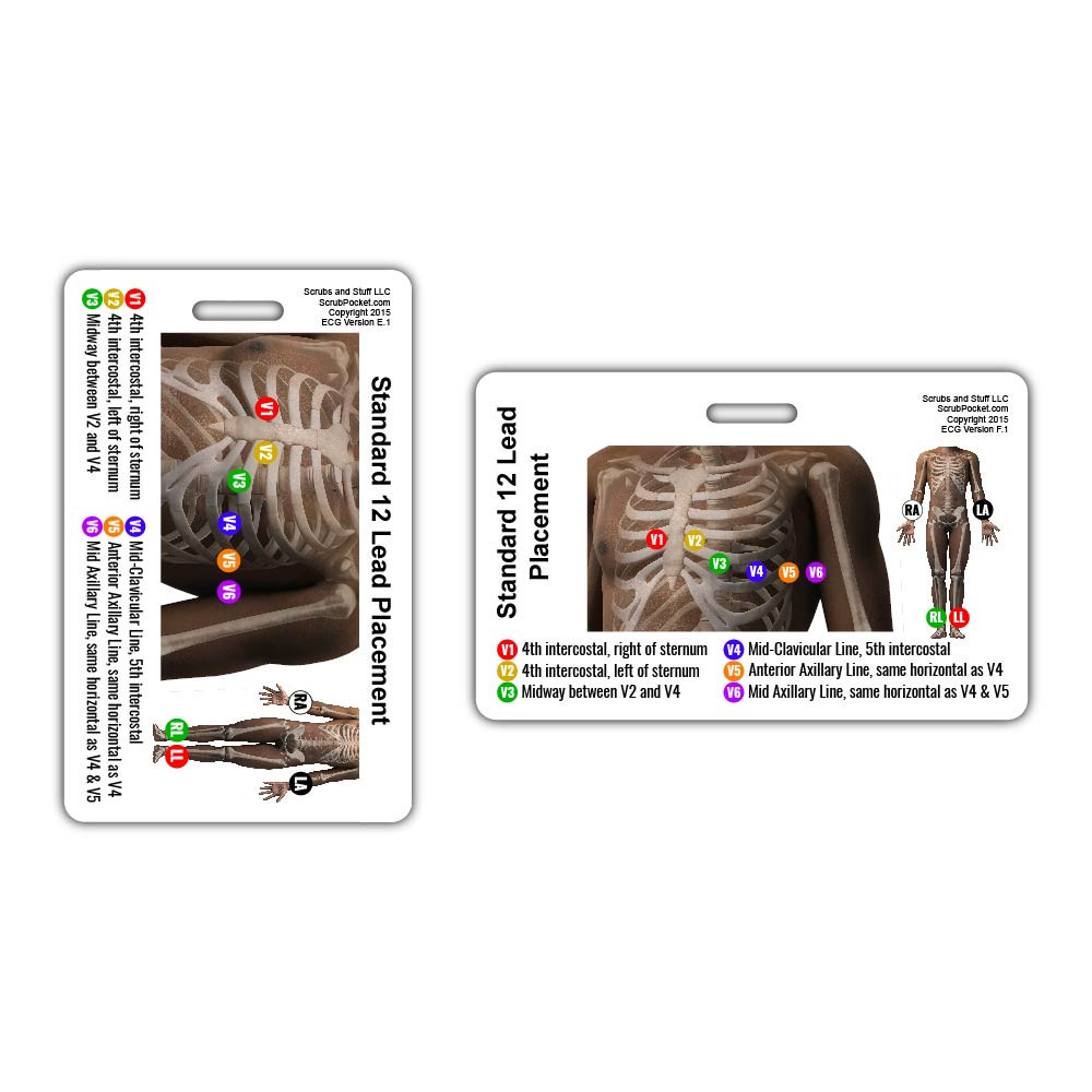 Ekg Placement Mastering 12 Lead ECG Placement