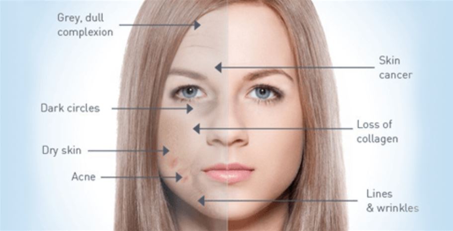How Toxins Affect Your Skin - SNP NATURALS