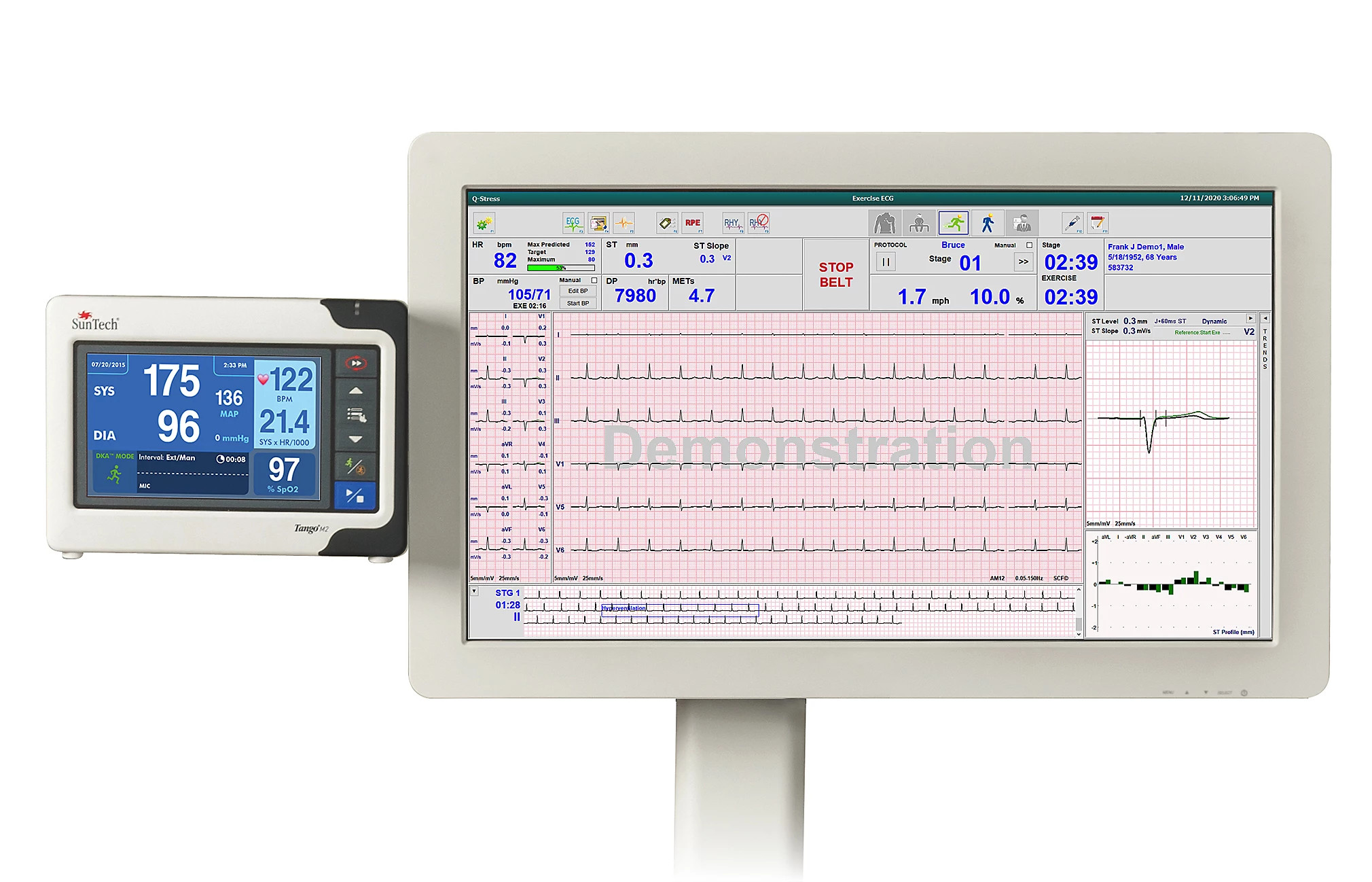 Welch Allyn Q-Stress Cardiac Stress Testing System QS6-ATTDX