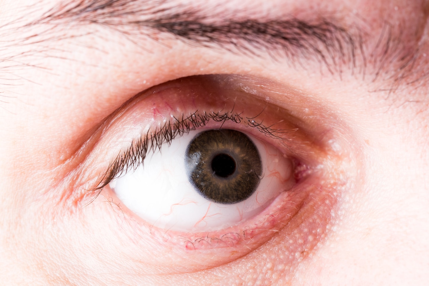 Enucleation And Evisceration - Part 1 - accuspire