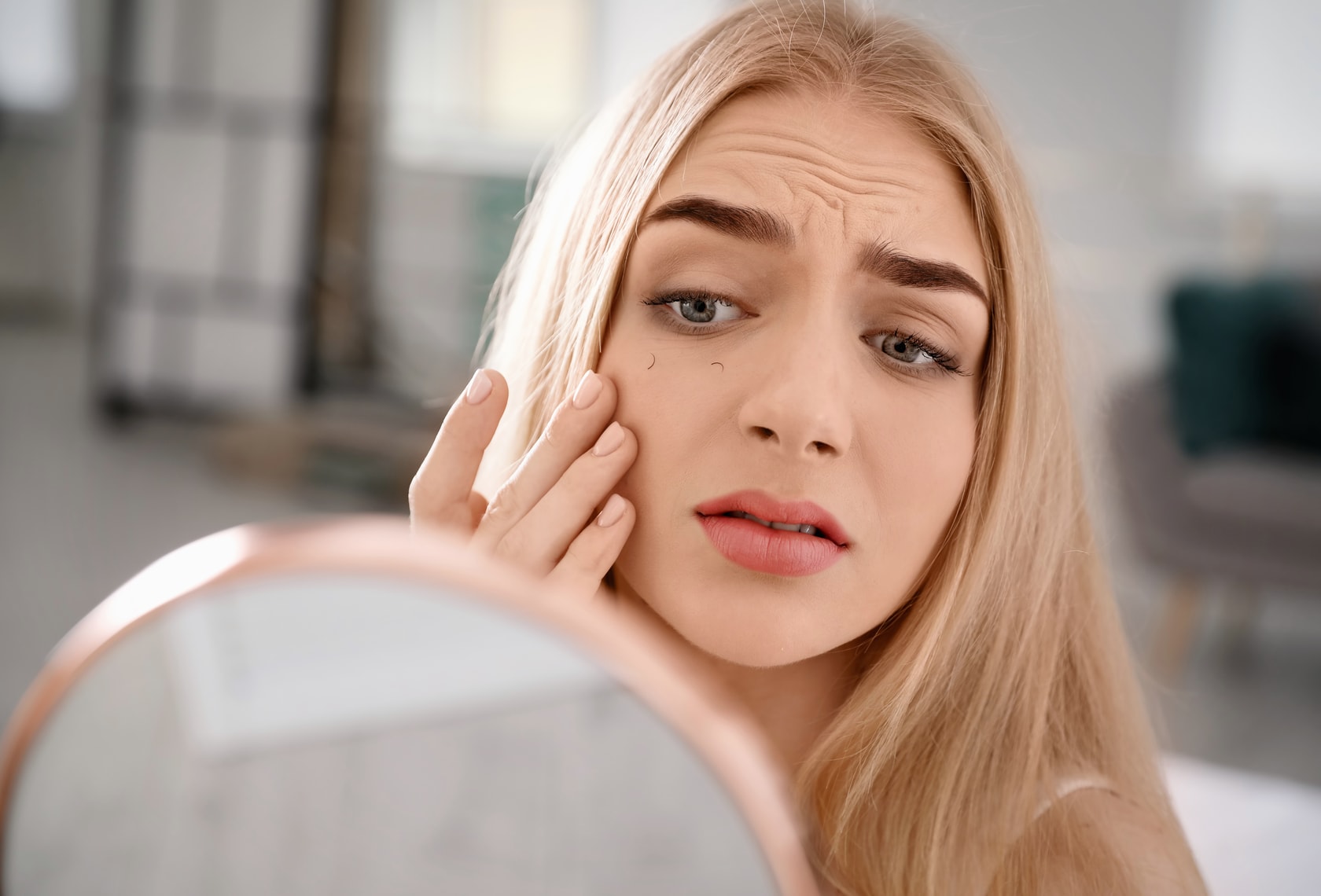Eyelash Loss And Other Hair Loss - accuspire