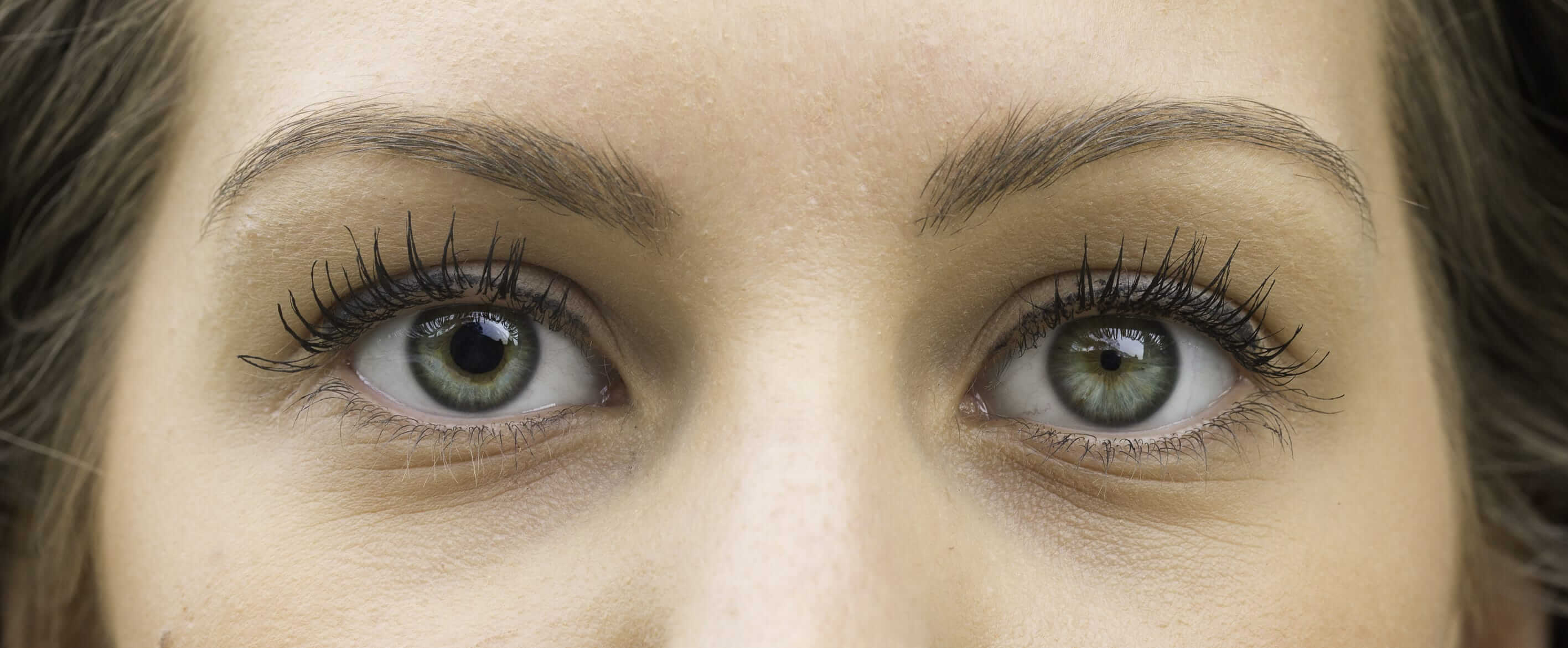 Anisocoria Diagnosis And Treatment Accuspire