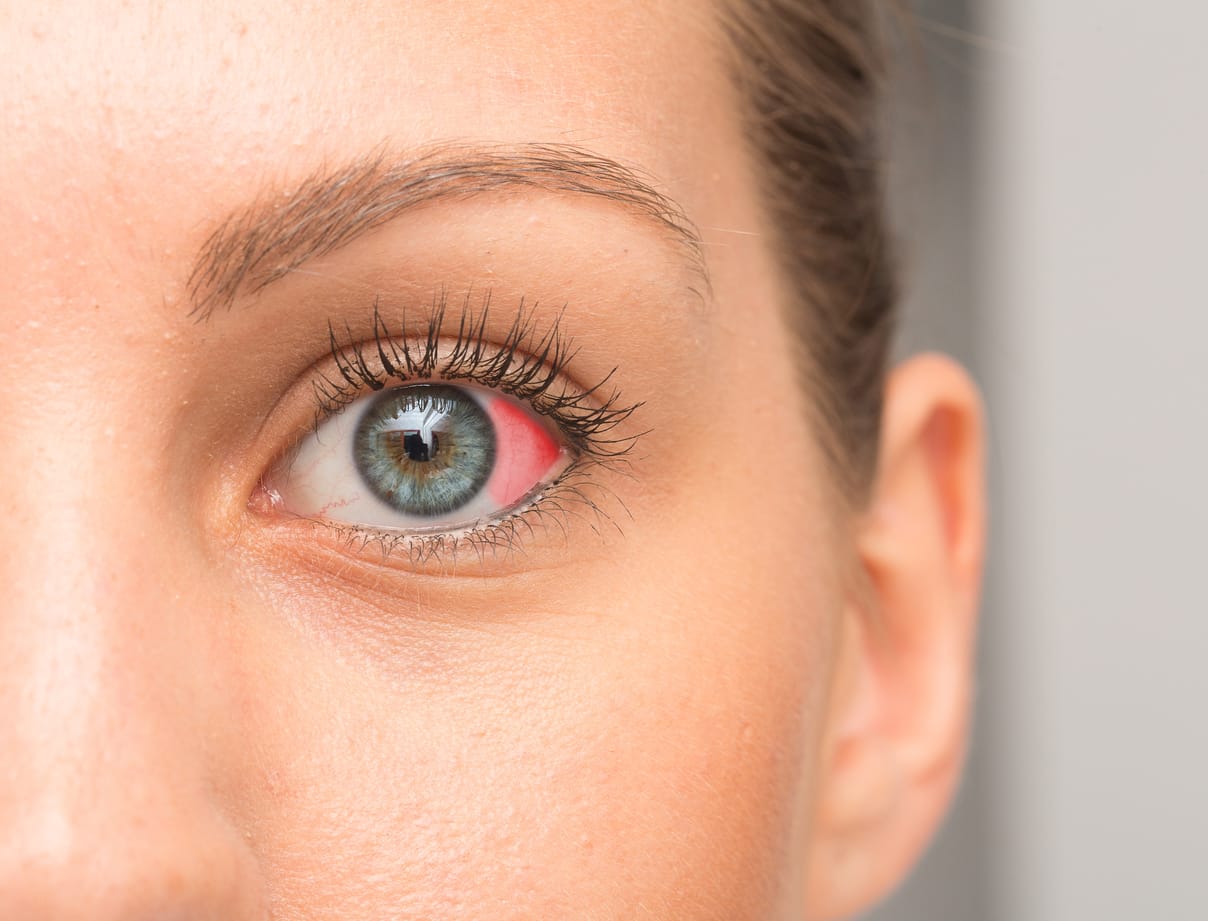 How Does Blood Pressure Affect The Eyes And Vision - accuspire