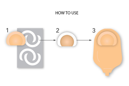 Stomadome Ostomy Shield & Velcro Crescents – Stoma Protection for ...