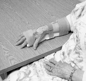 3M 2086 Coban Self-Adherent Wrap