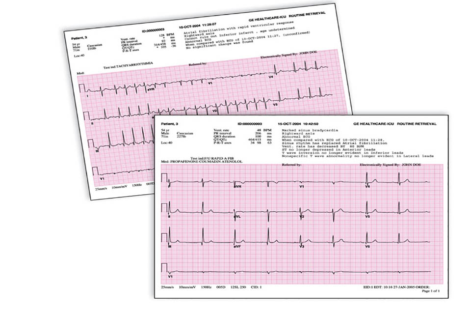 GE’s Marquette 12SL Algorithm Updates - Jaken Medical Inc
