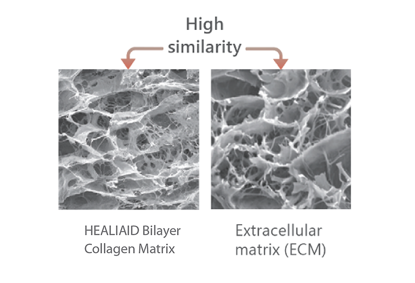 HEALIAID Bilayer Collagen Matrix I AD Surgical