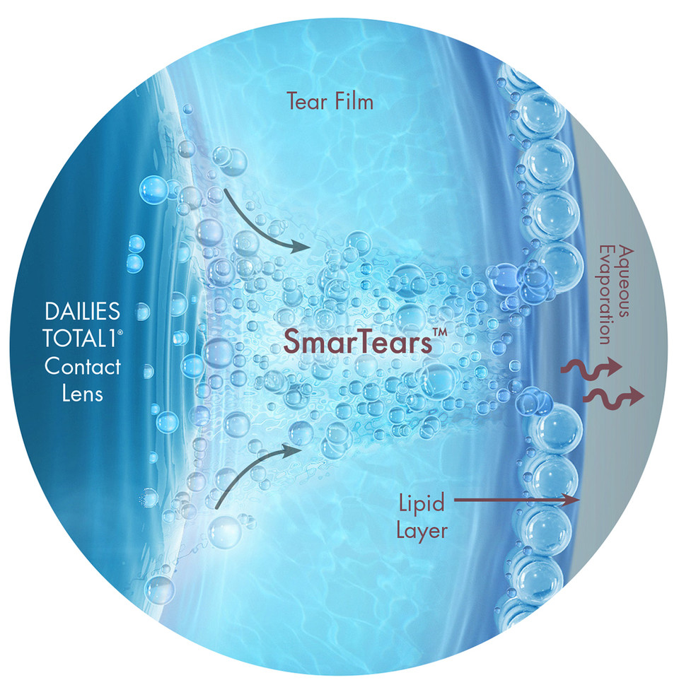 Alcon Dailies Total1 Contact Lenses (90pcs)