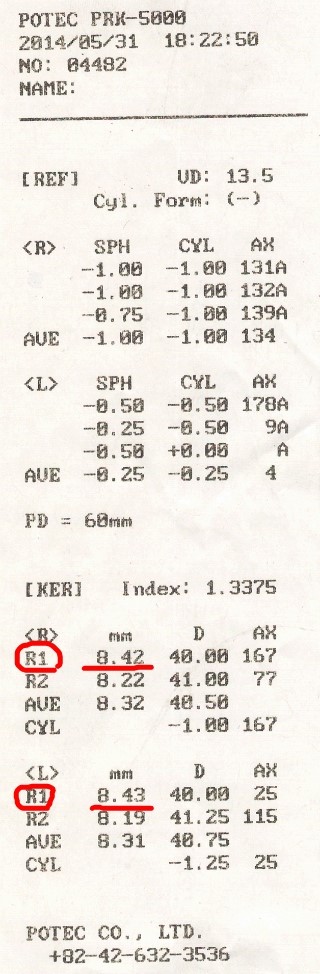 How To Check Eye Shape, How To Check Lens Size, Check Various ...