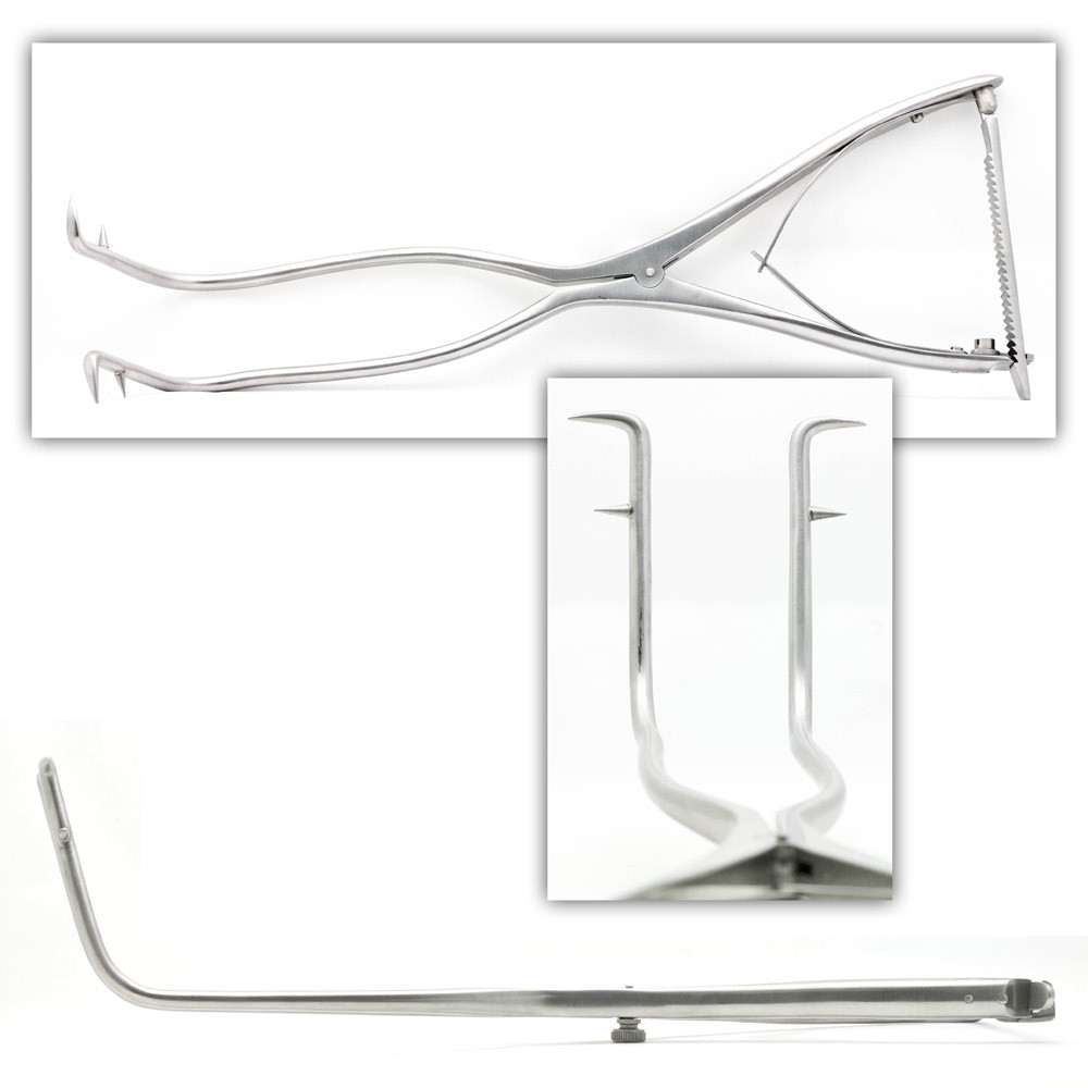 Mcbride Retr Large 13.75In Custom | 1-3316C - Millennium Surgical