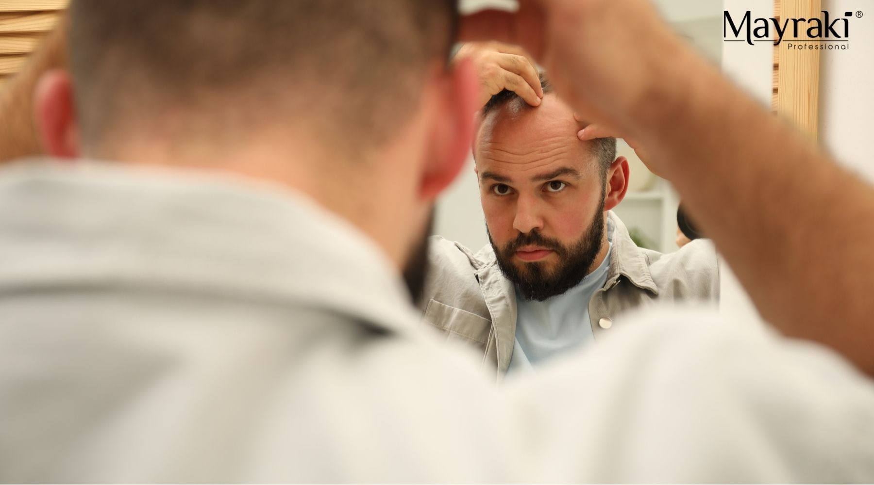 How to Prevent Receding Hairlines in Men: Effective Strategies That ...