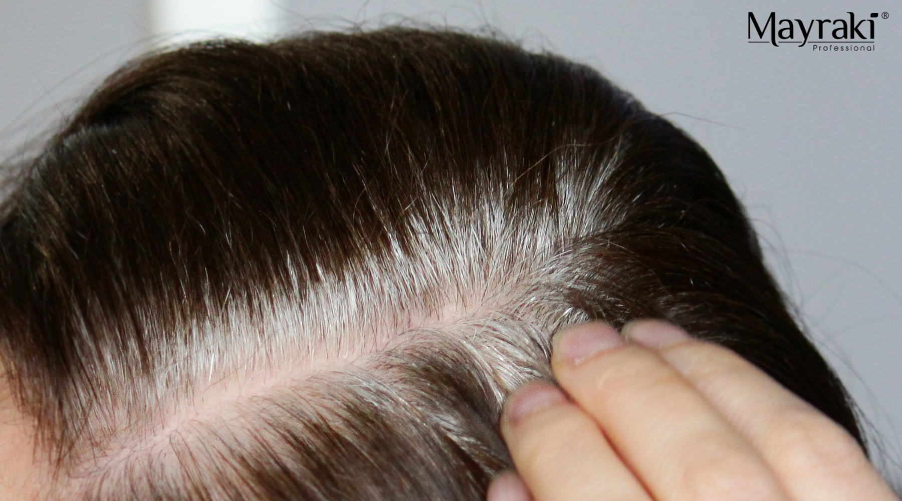 How to Use Natural Ingredients to Reverse Gray Hair: Restore Pigment ...