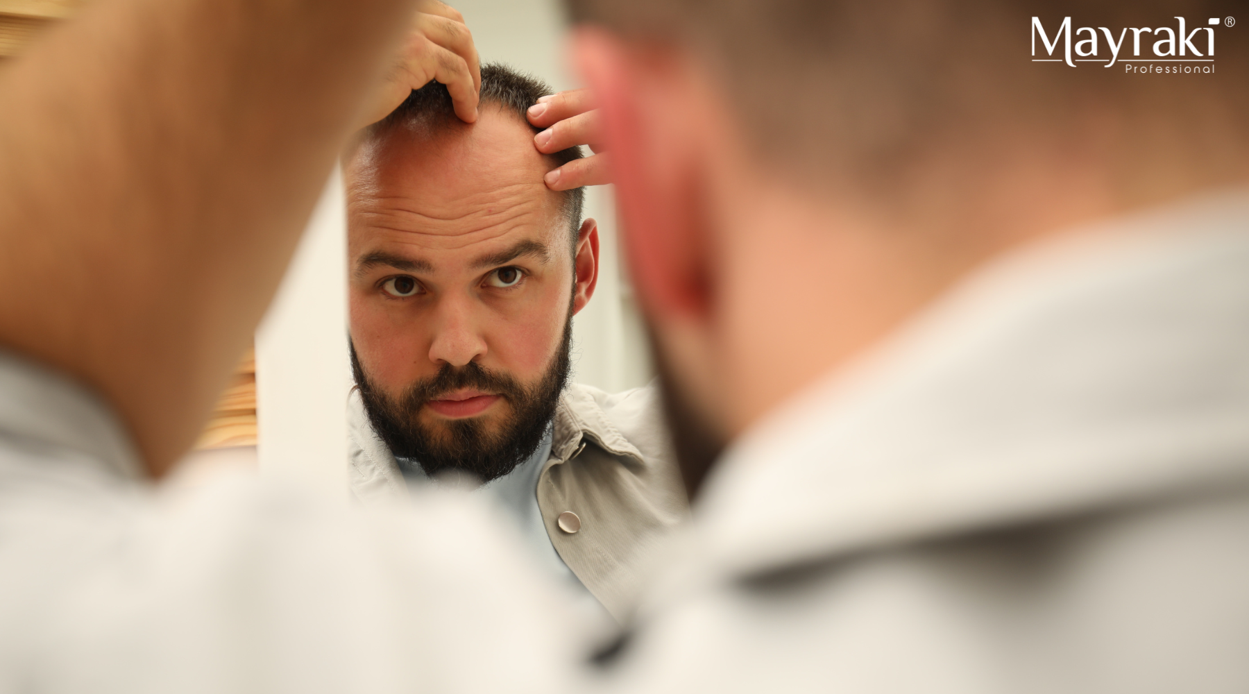 How to Deal with Receding Hairlines in Men: Natural and Practical ...