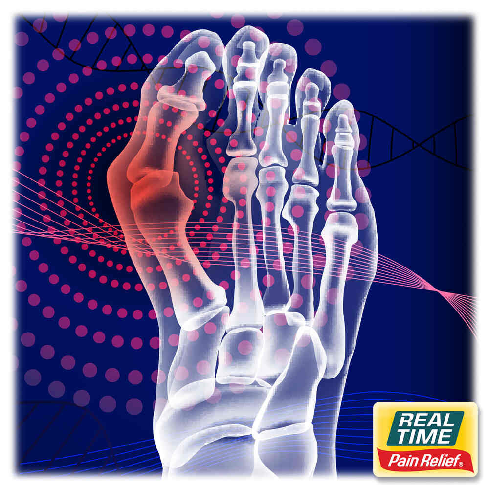 Rheumatoid Arthritis: A Comprehensive Overview - Real Time Pain Relief