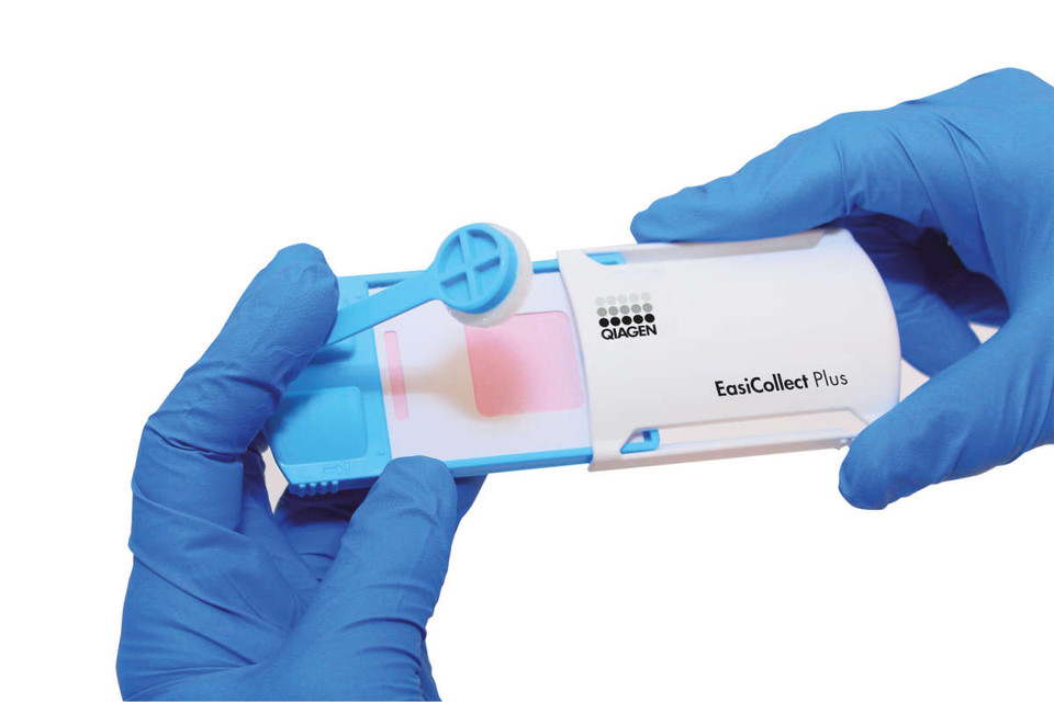 Specimen Collection - Swabs - EasiCollect + Buccal Sample Collection ...