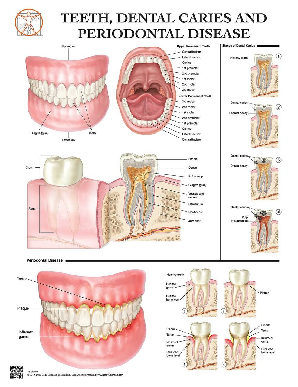 Anatomy Model Diseased Teeth and Gums