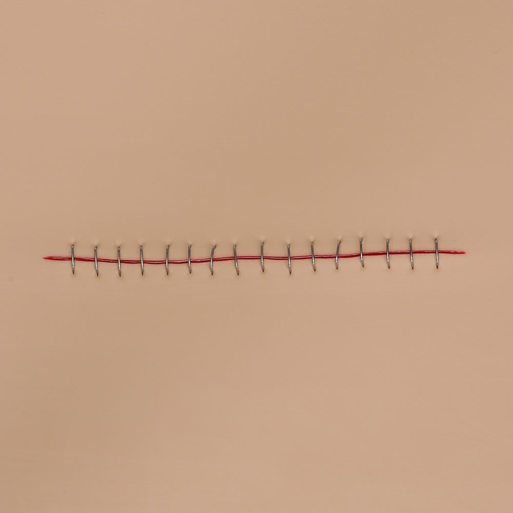 VATA Stapled Incision Wound Board | Anatomy Warehouse