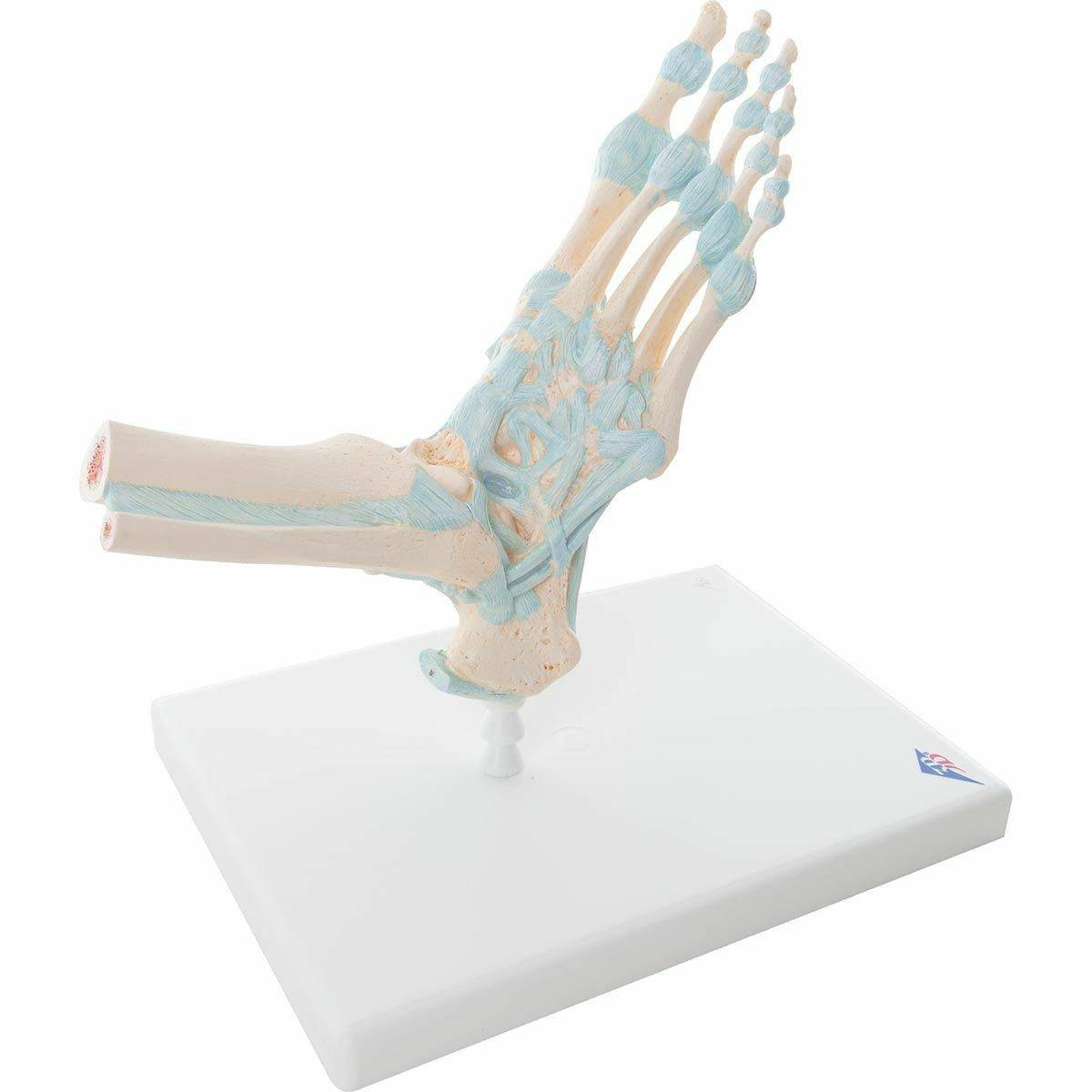 Anatomy Model Pes Hollow Foot (Pes