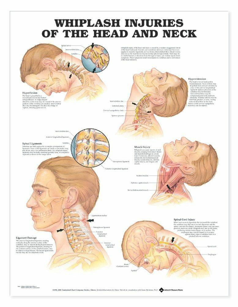 Anatomical Chart Company Head and Neck Laminated Anatomical Chart ...