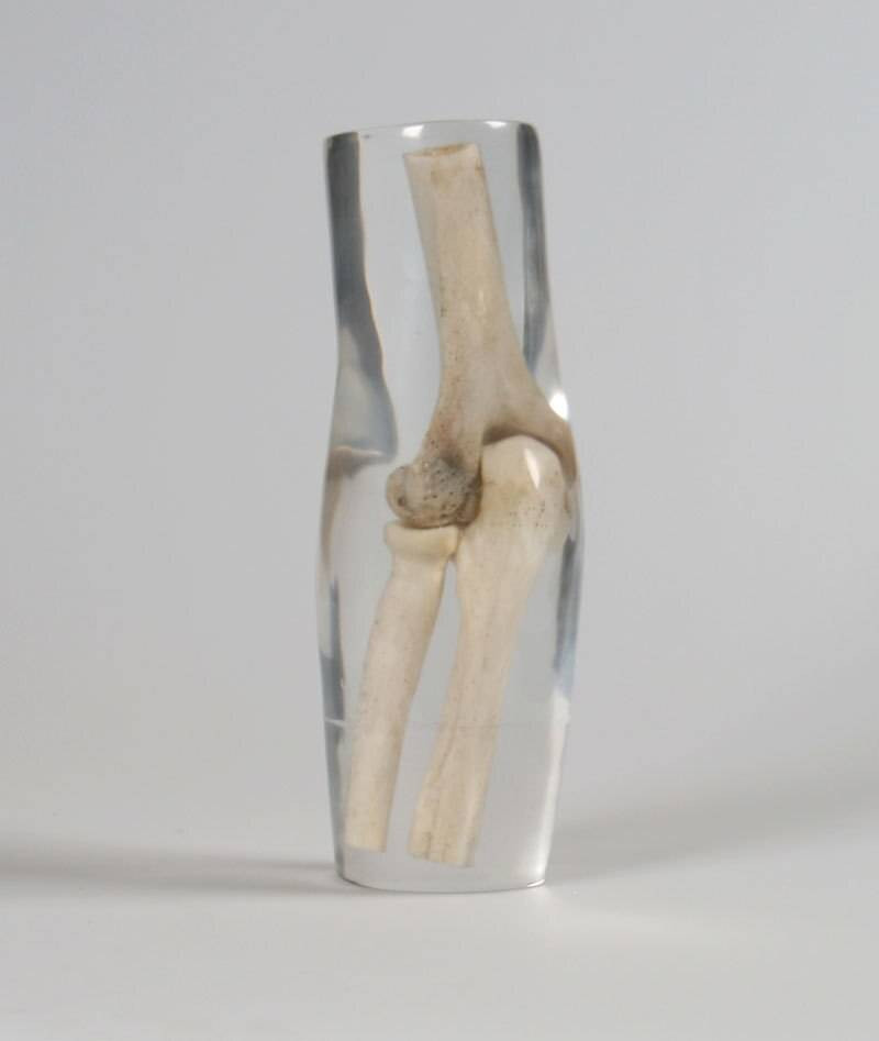 Erler-Zimmer - X-Ray Phantom Knee, Transparent