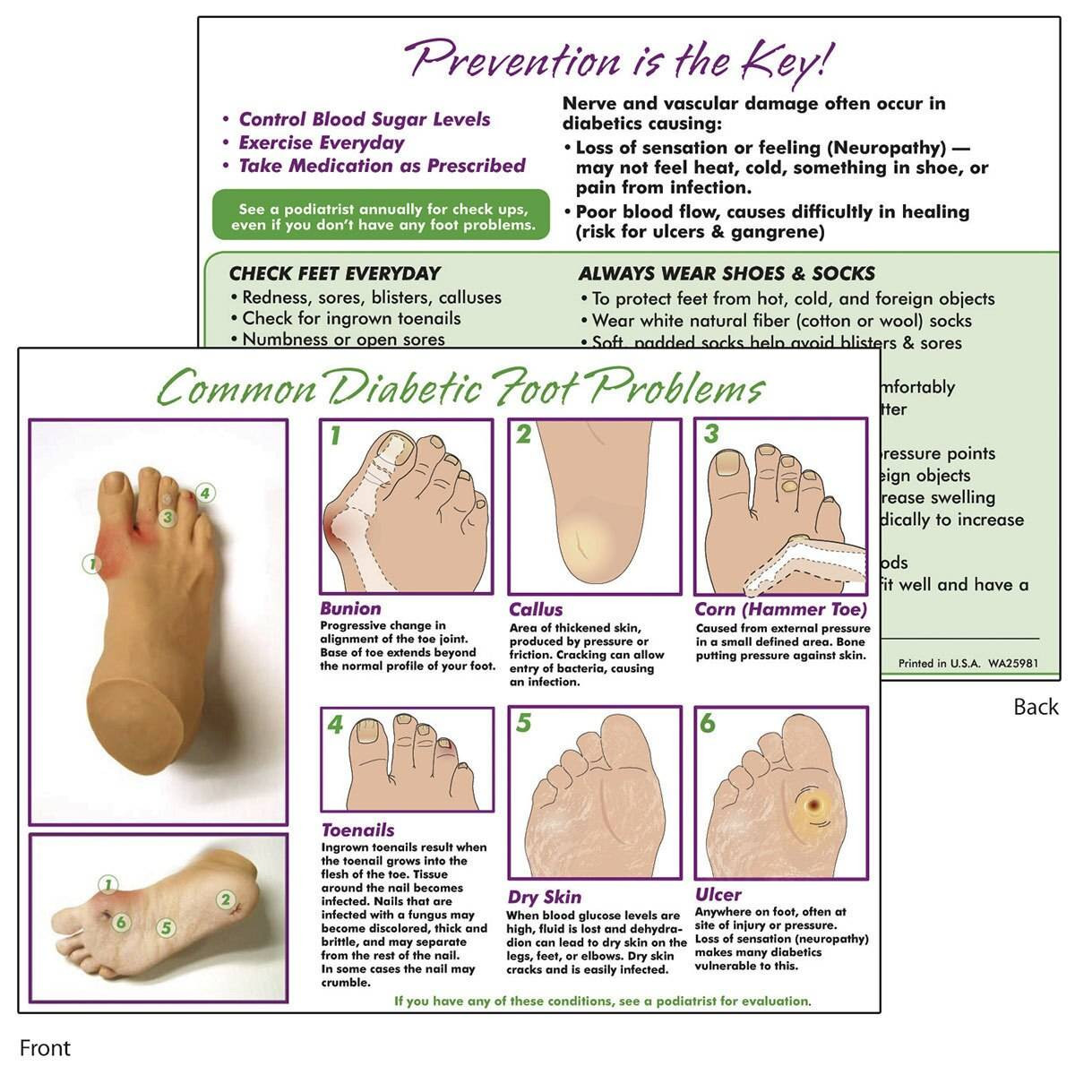 Nasco Healthcare Common Diabetic Foot Problems TearPad | Anatomy Warehouse