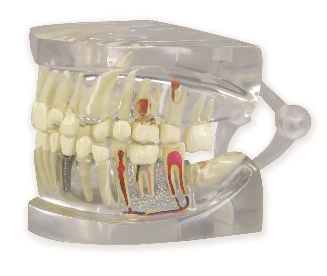 Teeth Anatomy Model