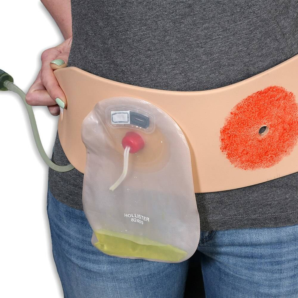 Replacement Flush Stoma for Use with Ostomy Pouching Trainer