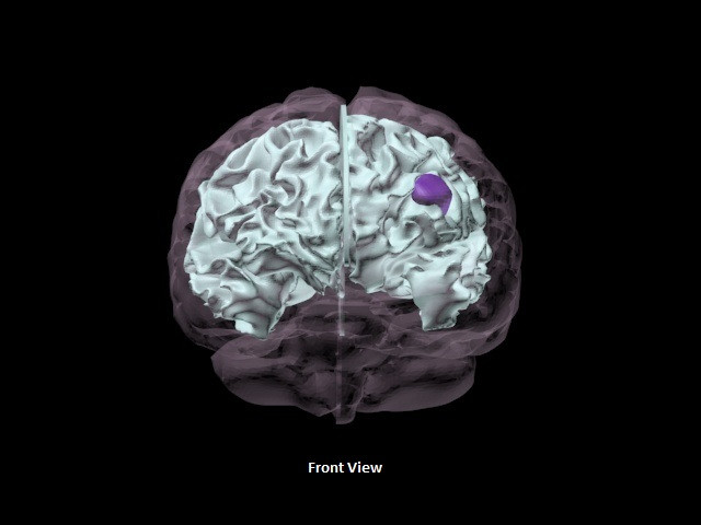 Basic Adult Brain Phantom Model
