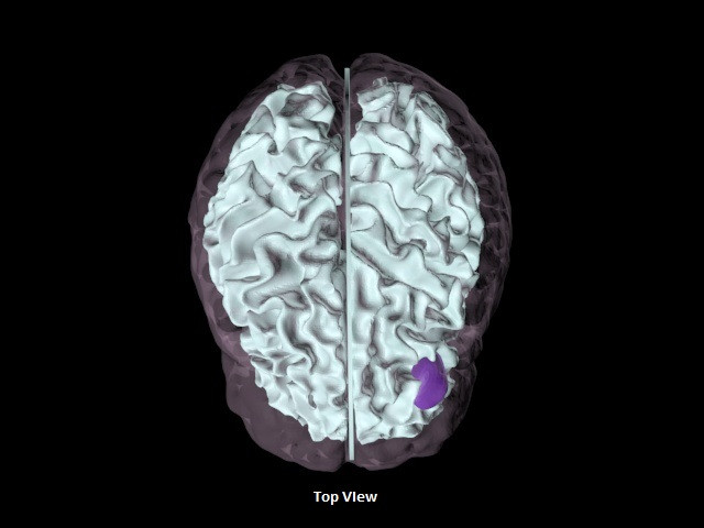 Basic Adult Brain Phantom Model