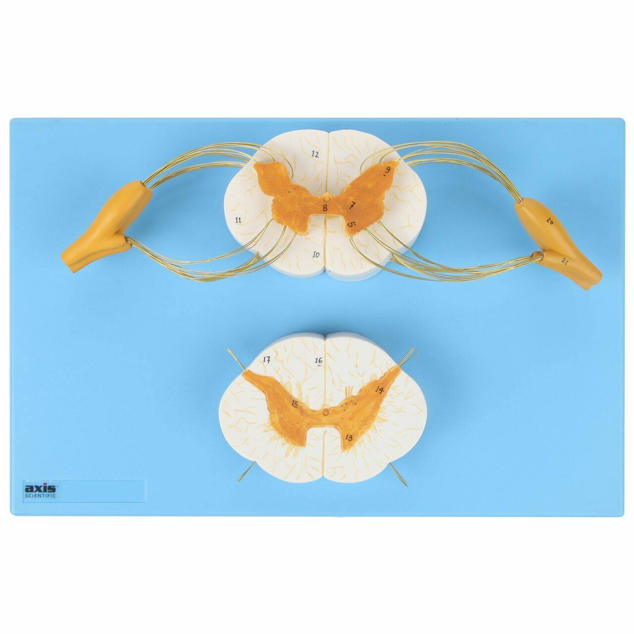 Axis Scientific Life-Size Skeletal Human Torso with Glenohumeral and ...
