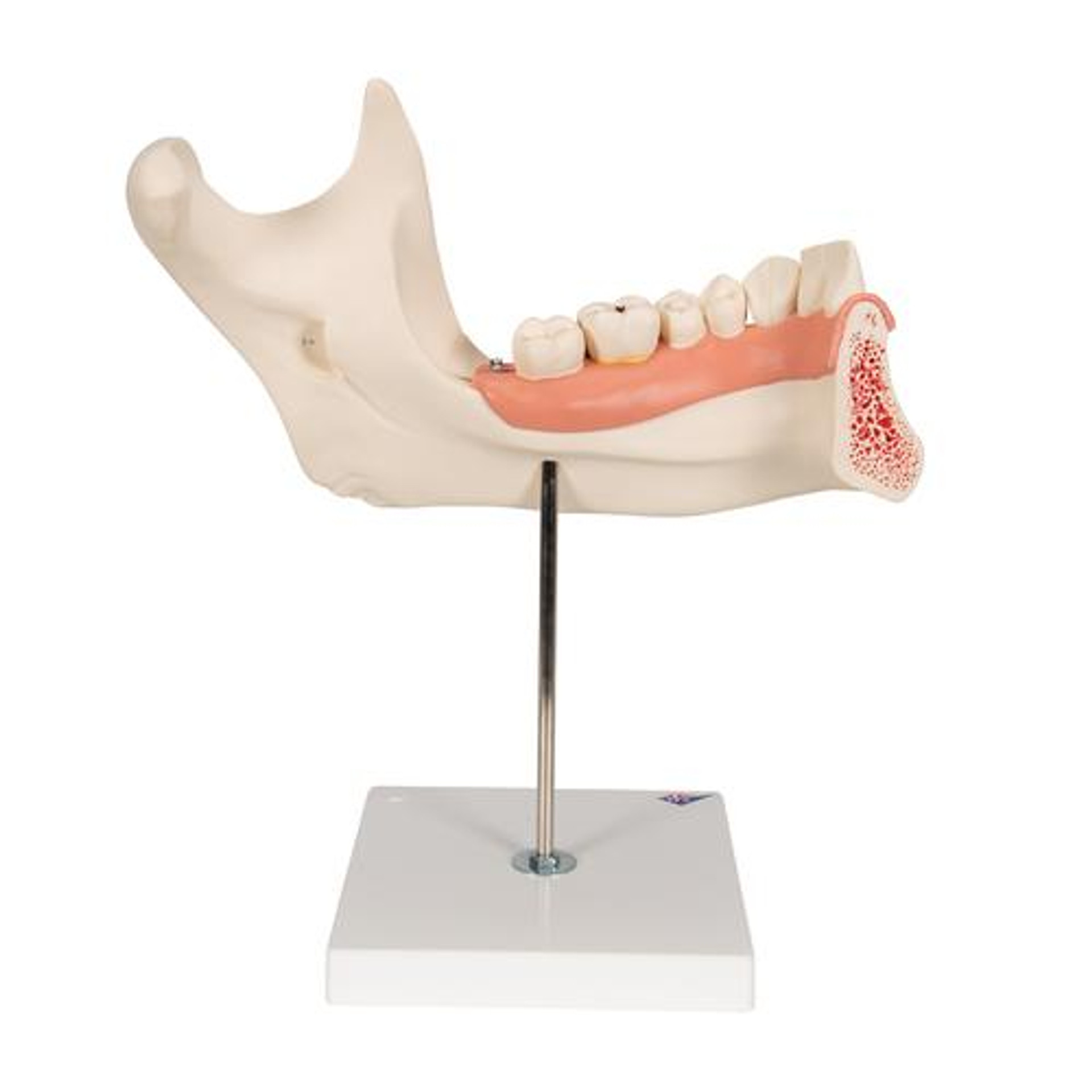 3B Scientific - Half Lower Jaw Anatomy Model