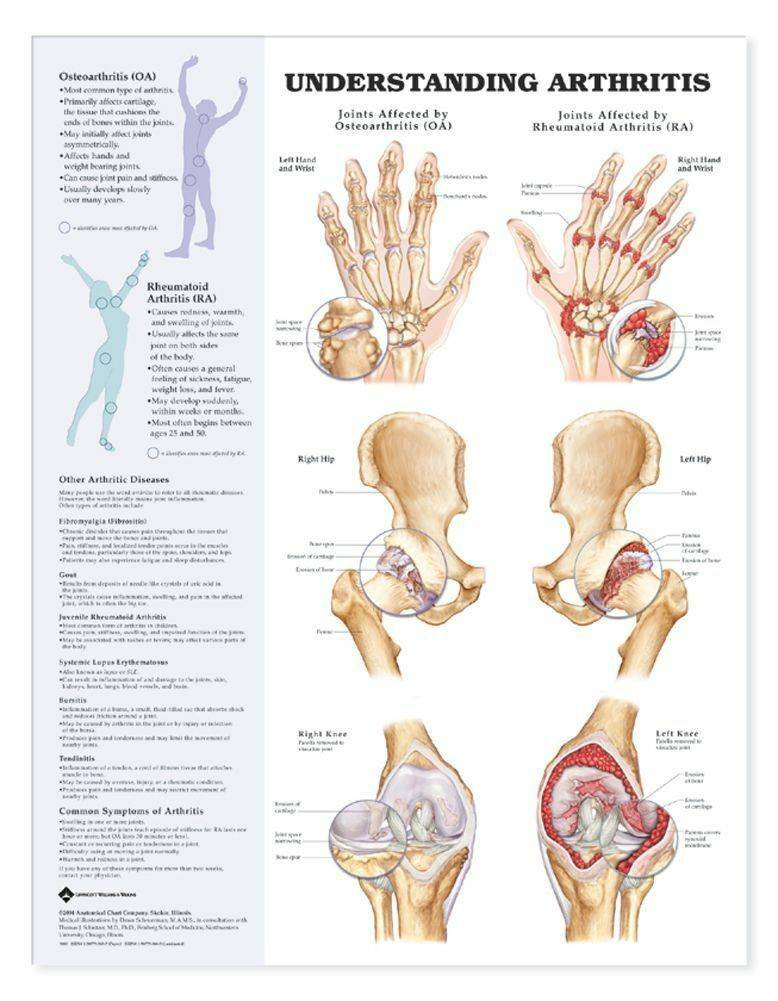Anatomy Chart Understanding Influenza