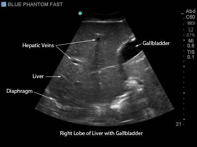 FAST Exam Real Time Ultrasound Training Model
