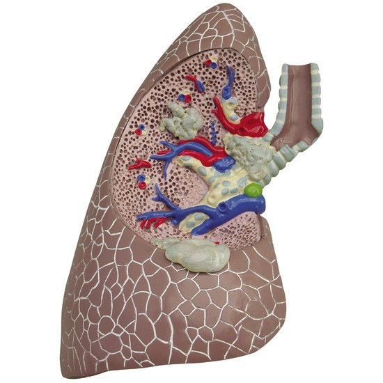 Anatomy Model Lung