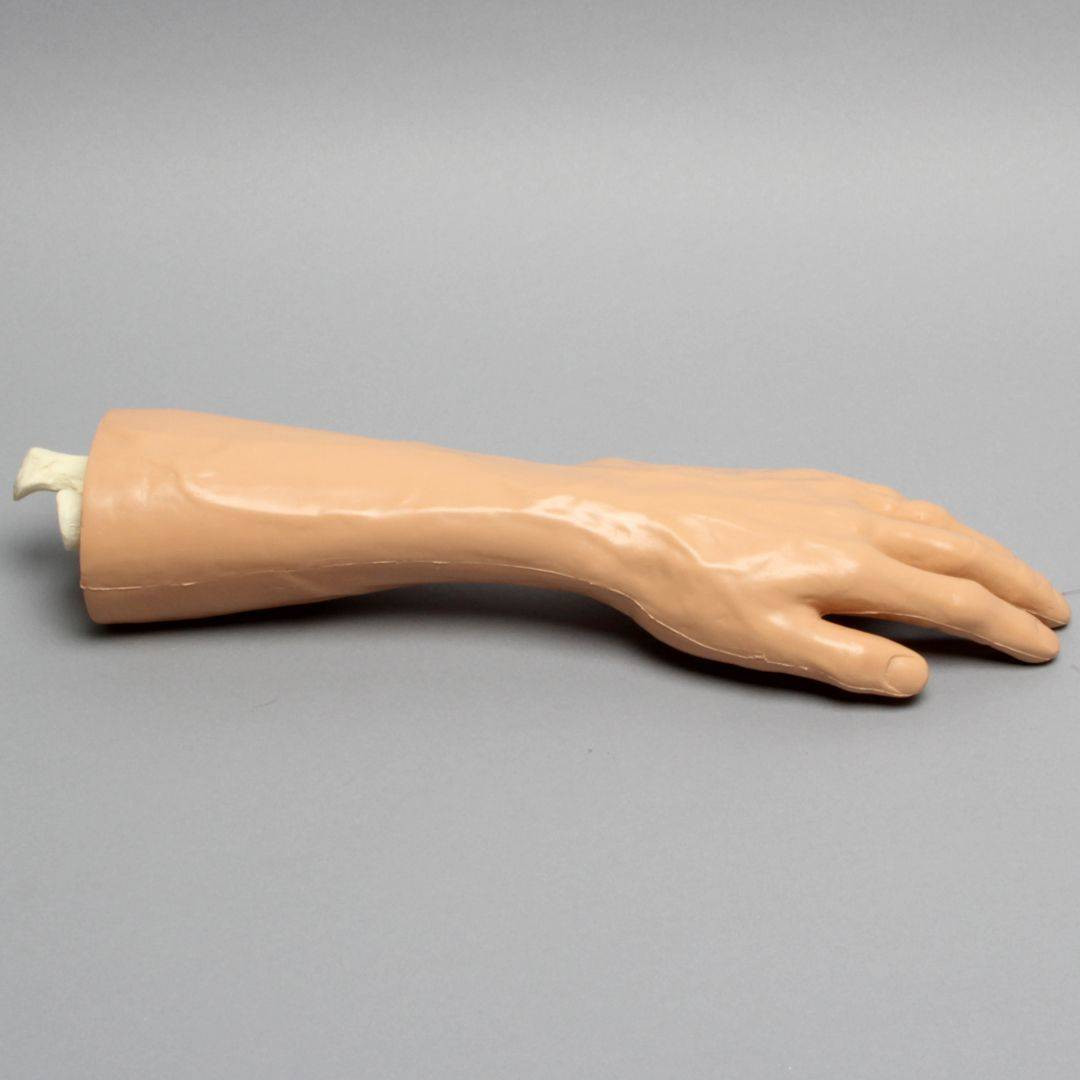 Sawbones Encased Hand Wrist with Solid Foam Ulna, Radius, and Hand ...