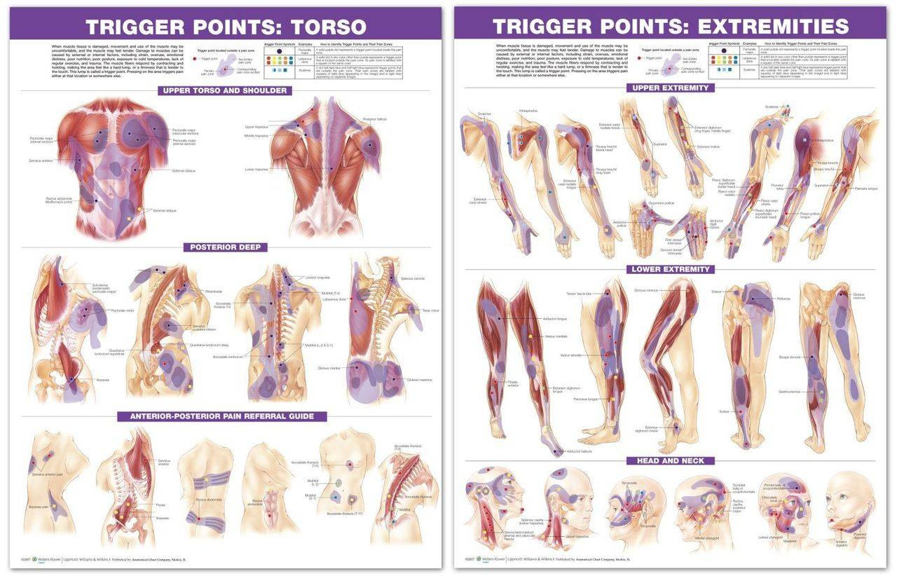 Rudiger Anatomie Trigger Points Laminated Chart | Anatomy Warehouse