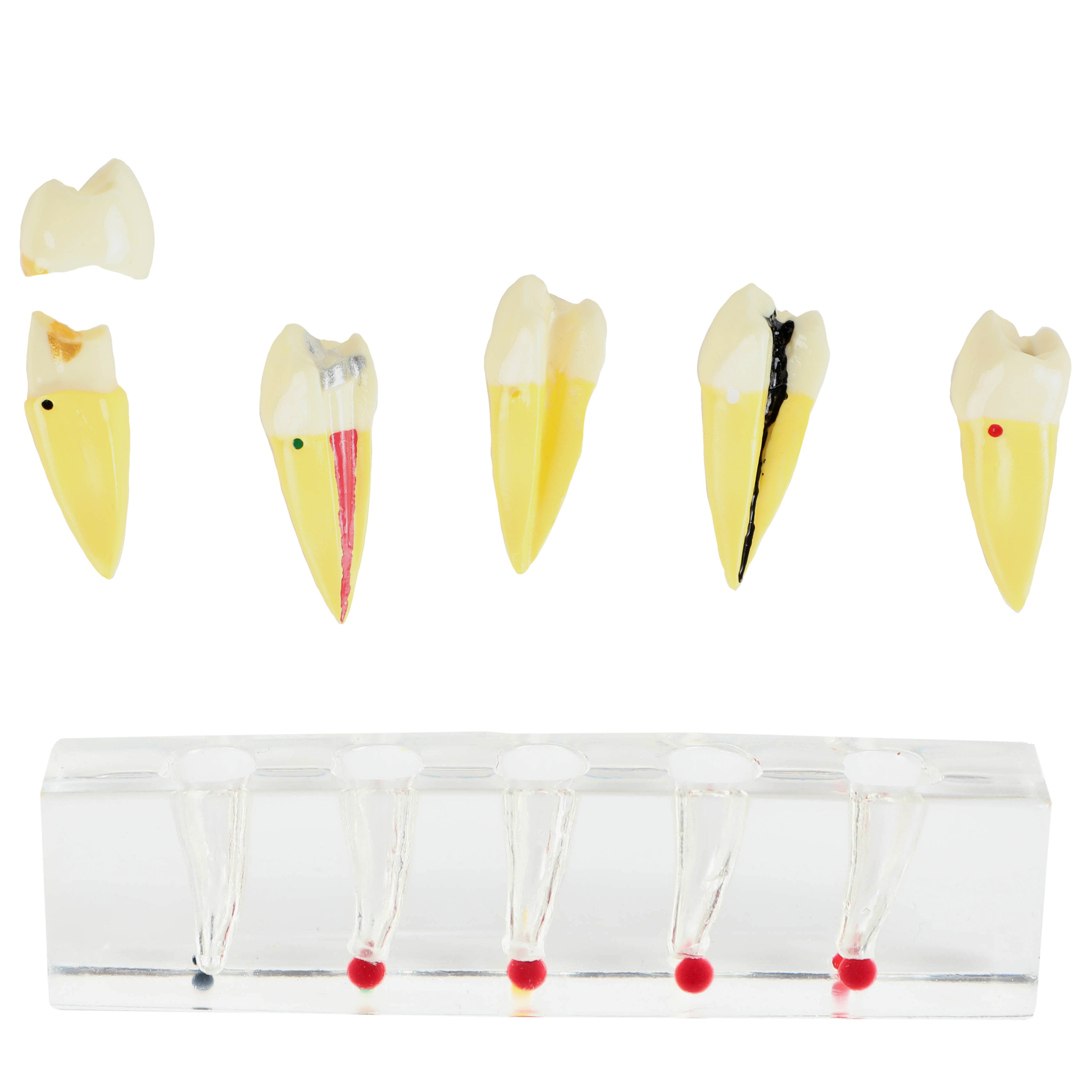 Axis Scientific - Dental Pulp Repair Anatomy Model