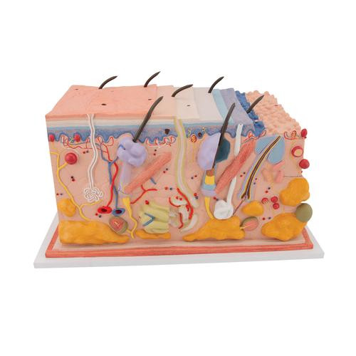 Anatomy Model Human Skin with Burn Pathologies