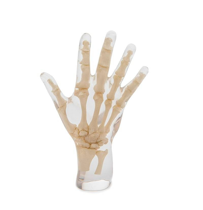 Erler-Zimmer - X-Ray Phantom Knee, Transparent