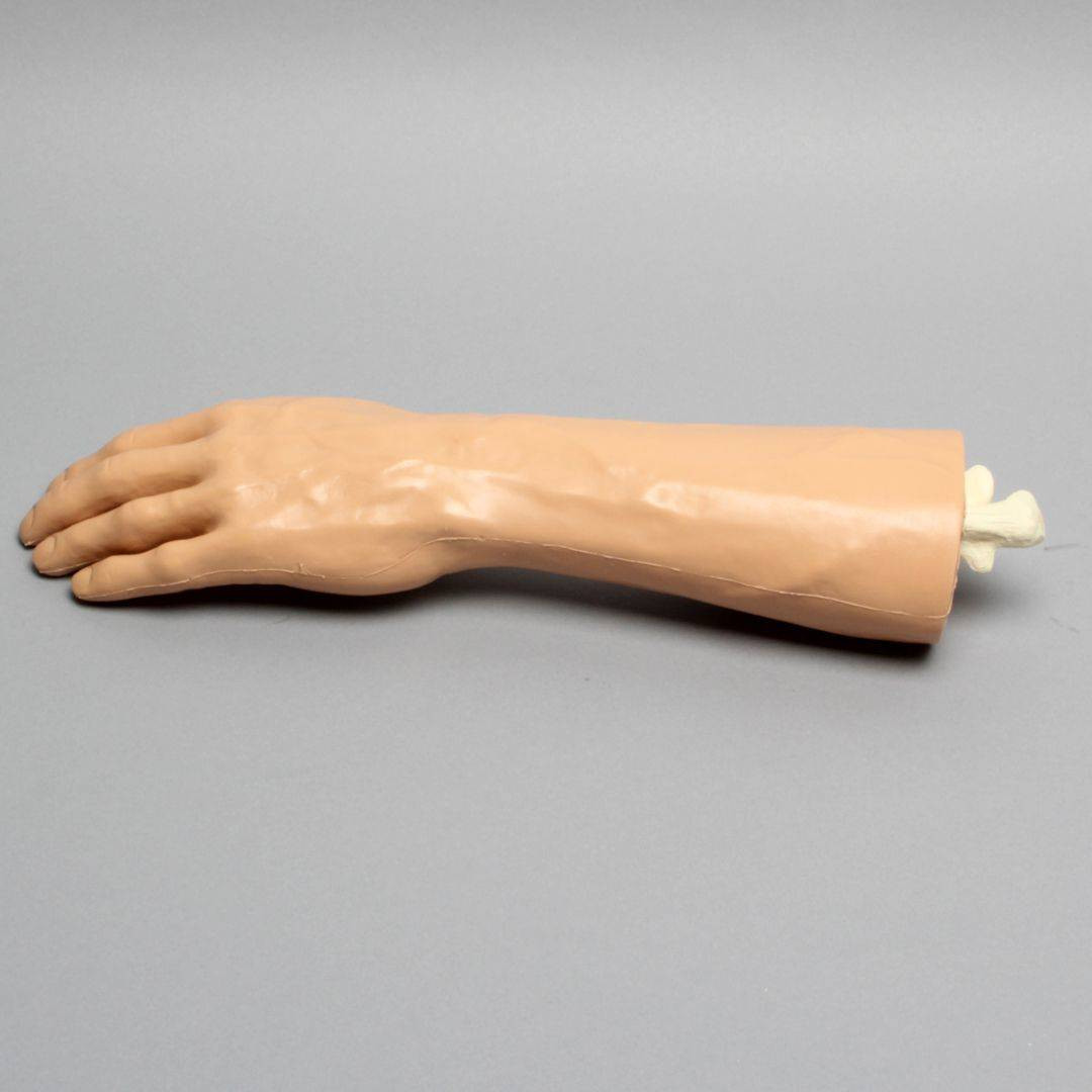 Sawbones Encased Hand Wrist with Solid Foam Ulna, Radius, and Hand ...