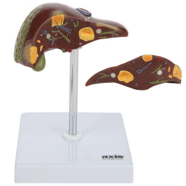 Axis Scientific - Liver Anatomy Model Set