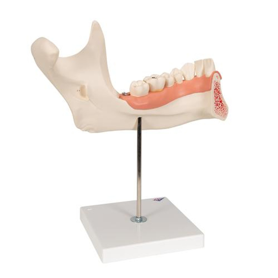 3B Scientific - Half Lower Jaw Anatomy Model