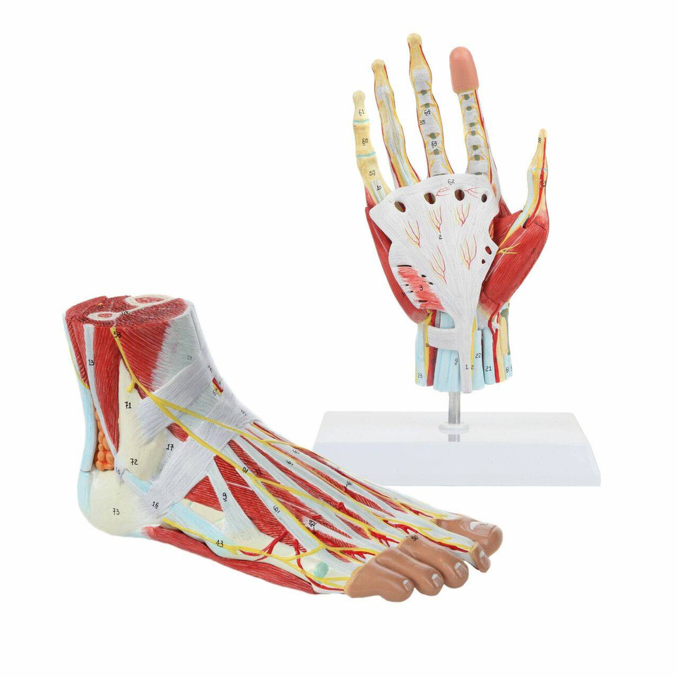 Anatomy Model Hand Osteoarthritis