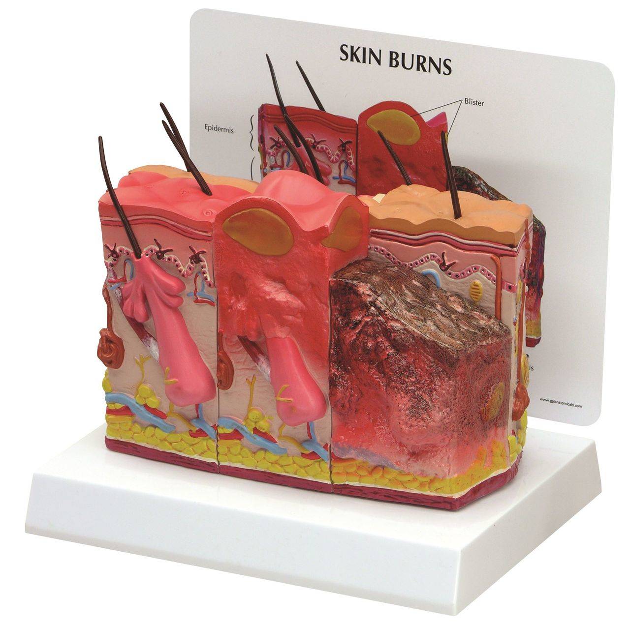 Anatomical Skin Grid Human Skin Map Gives 'recipe' To Build Skin A