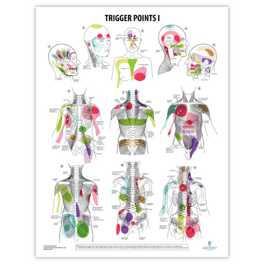Anatomy Lab Trigger Points I Laminated Poster | Anatomy Warehouse