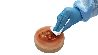 Medical-X Decubitus Stage 3 Ulcer Care Task Trainer | Anatomy Warehouse