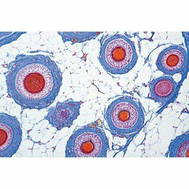 3B Scientific Human Scalp and Hair - English Slides | Anatomy Warehouse